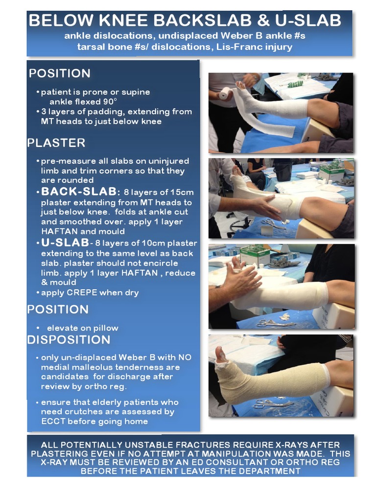 Below Knee Backslab & U-Slab Guide | PDF