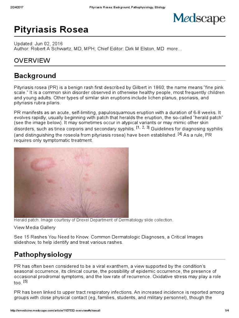Pityriasis Rosea - Background, Pathophysiology, Etiology | PDF ...