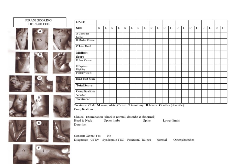 Pirani-score-form.pdf