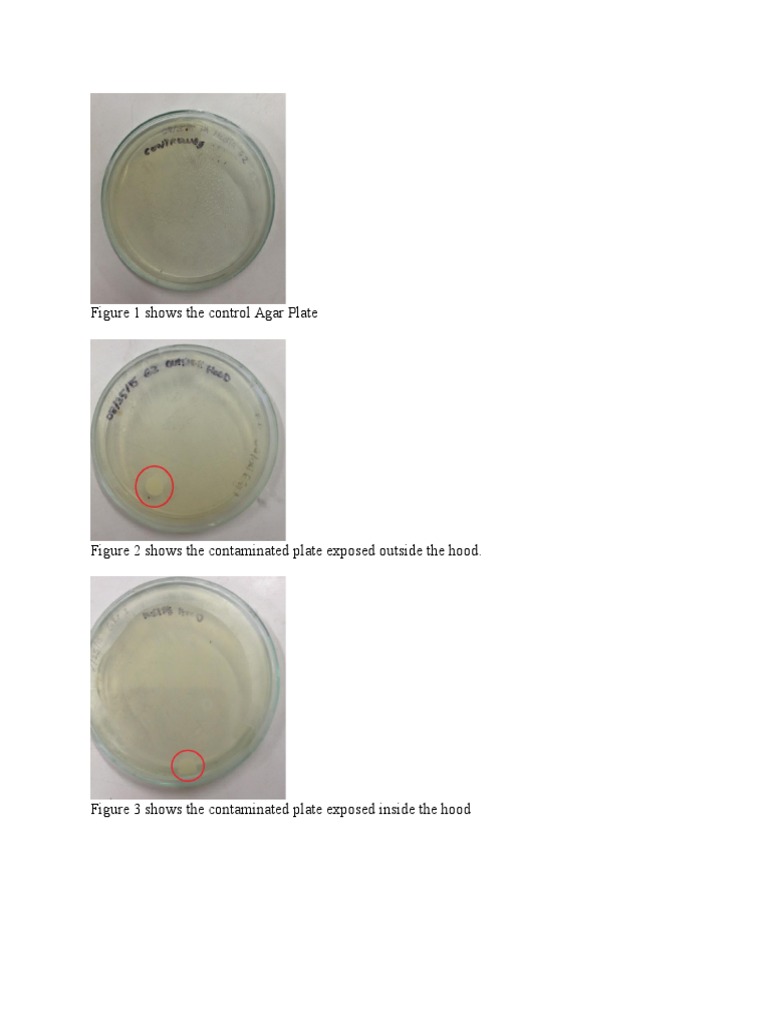 Figure 1 Shows The Control Agar Plate | PDF