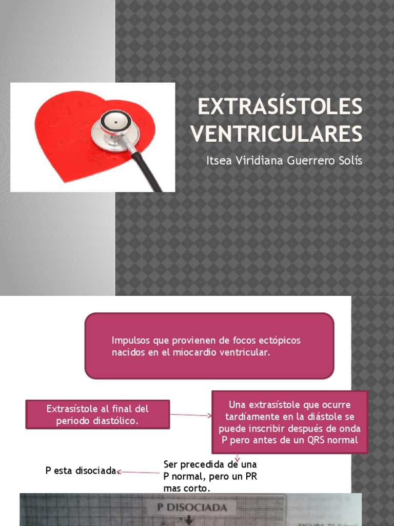Extrasístoles Ventriculares | PDF | Electrocardiografia | Fisiología