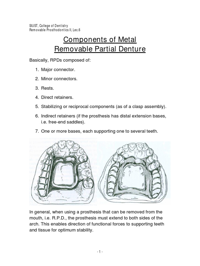 Removable Prosthodontics II - Lec.6, Metal RPD Components - SIUST ...