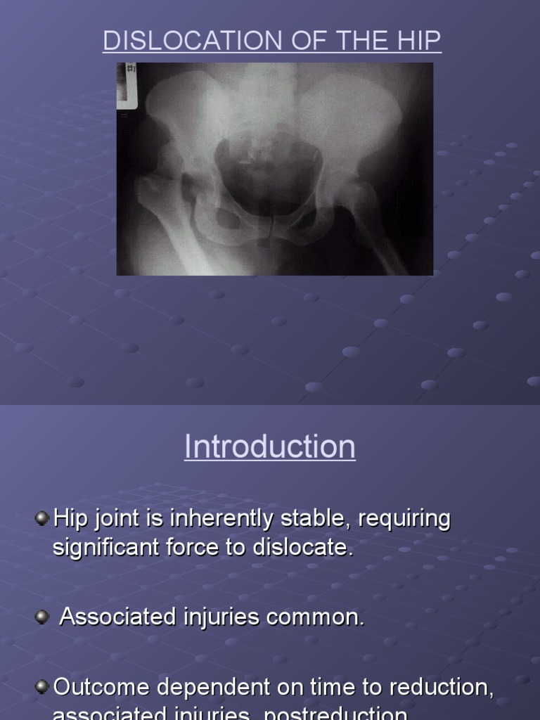 Hip Dislocation: Causes, Symptoms, and Treatment | PDF | Hip ...