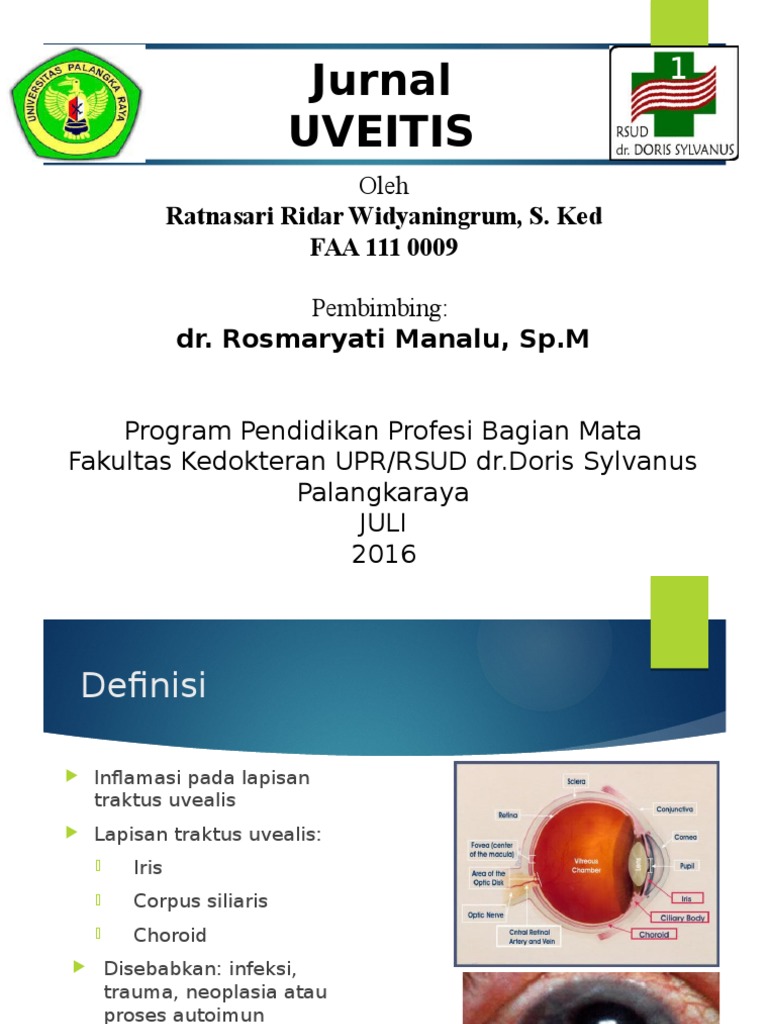 Jurnal - Uveitis | PDF