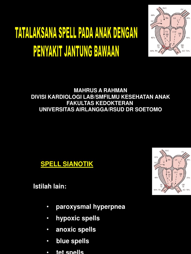 Tatalaksana Spell Sianotik pada TOF | PDF | Kesehatan Holistik