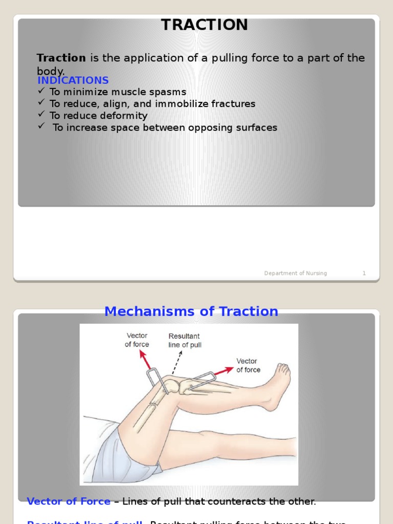 Principles and Applications of Traction | PDF | Anatomical Terms Of ...