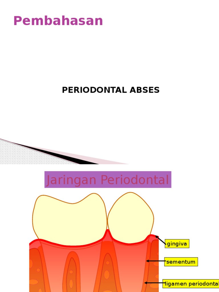 Abses Periodontal | PDF