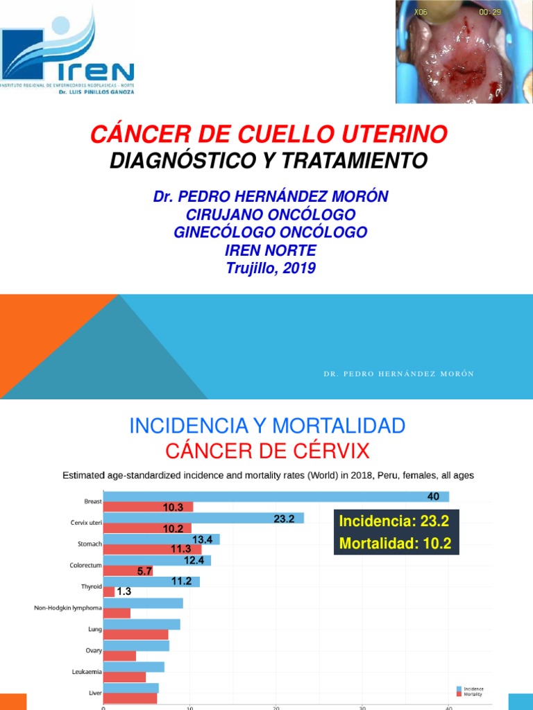 Cáncer de Cuello Uterino DX y TX Dr. Hernández 2019 | PDF | Neoplasias | Epidemiología