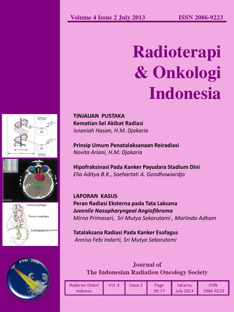 radioterapi onkologi