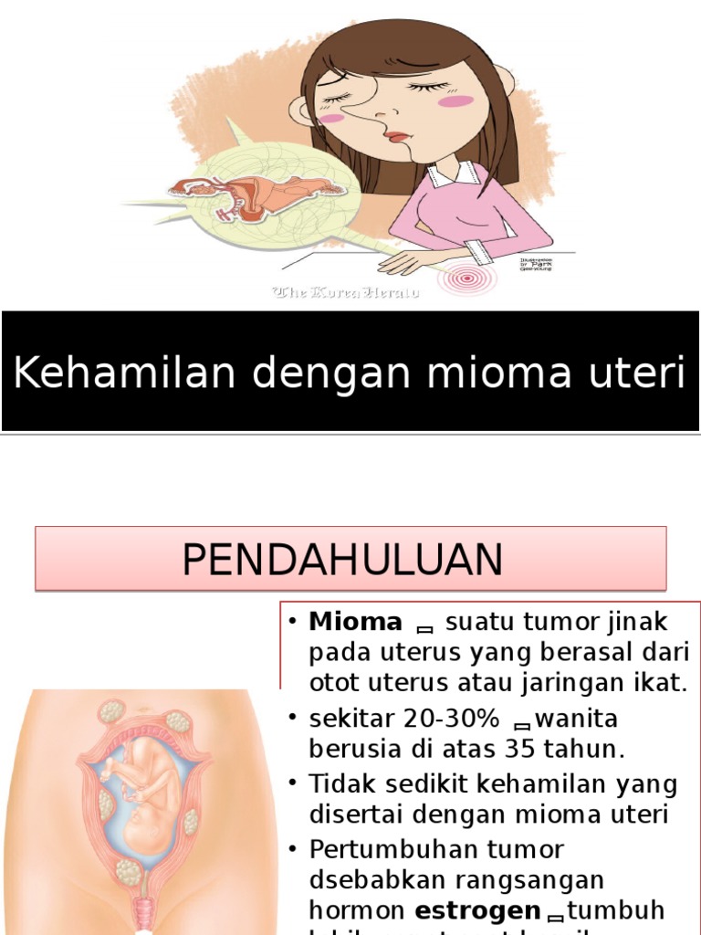 Kehamilan Dengan Mioma Uteri | PDF