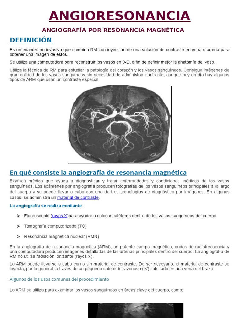 Angioresonancia: Definición y Usos | PDF | Angiografía | Imagen de ...