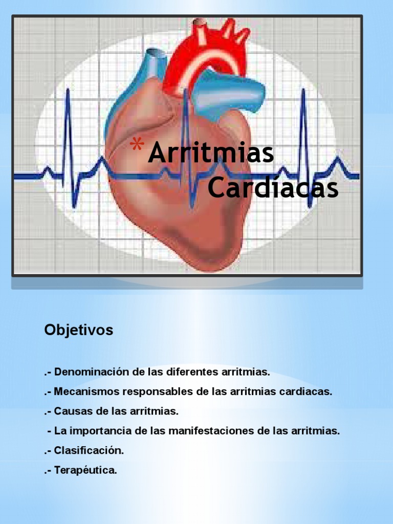 Arritmias | Arritmia cardiaca | Electrofisiologia | Prueba gratuita de 30 días | Scribd