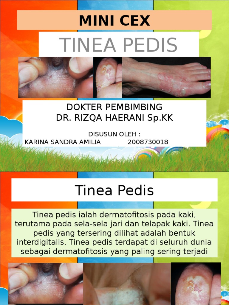 Tinea Pedis: Patofisiologi dan Tatalaksana | PDF