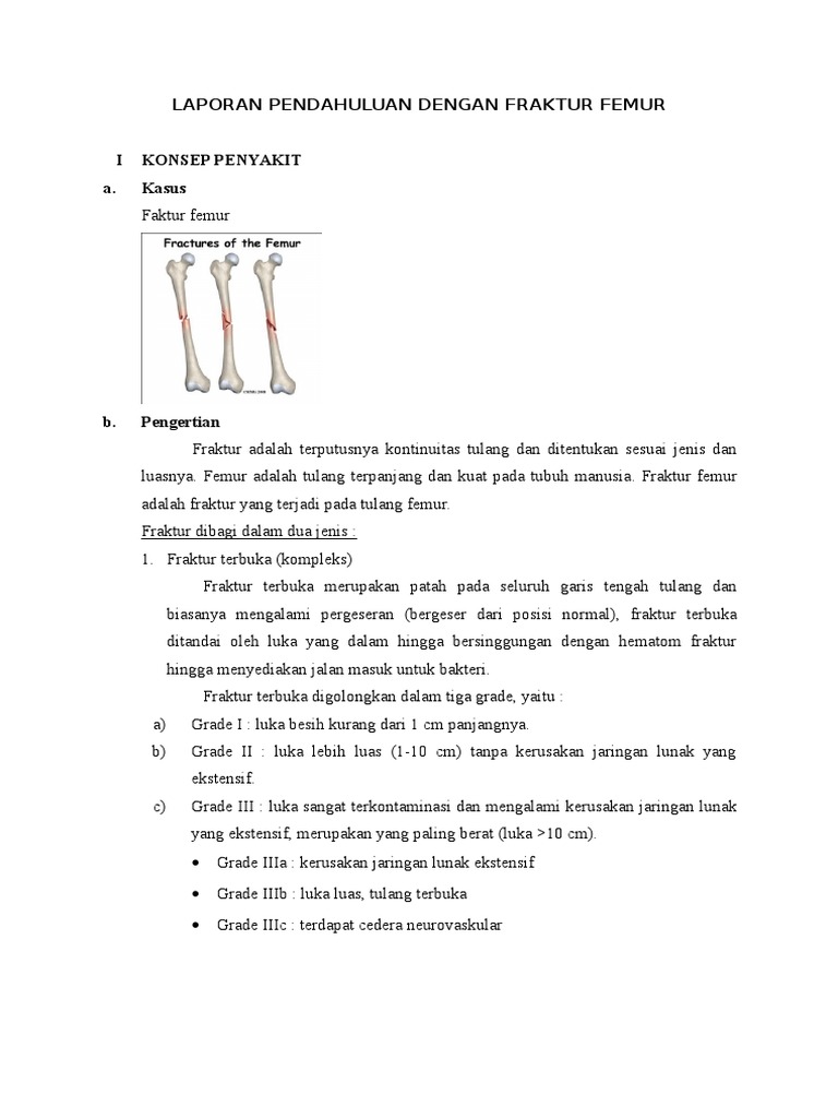 LP Fraktur Femur IGD | PDF