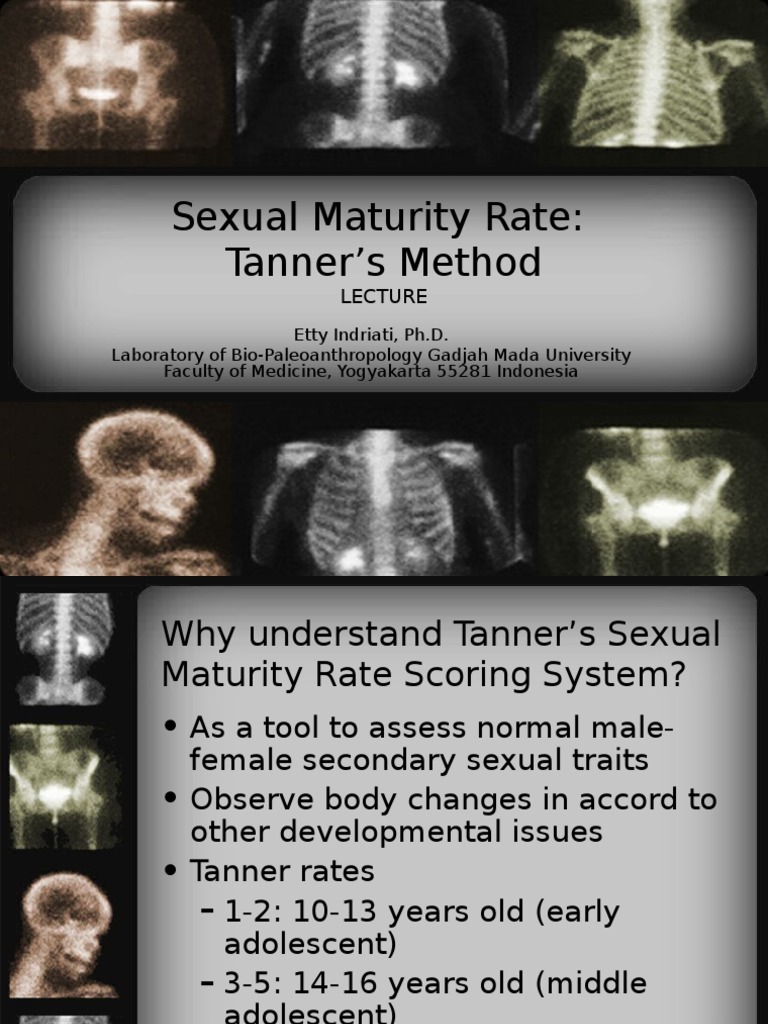 Sexual Maturity Rate Tanner's Method | PDF | Puberty | Adolescence