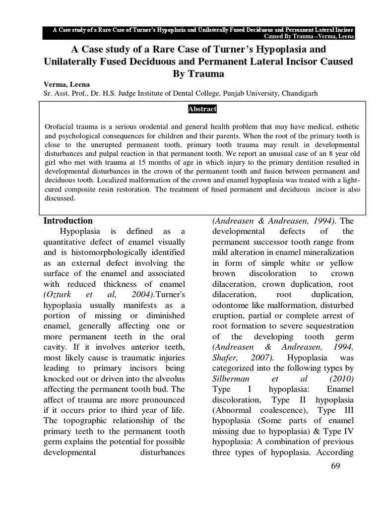 turner hypoplasia | Tooth Enamel | Tooth