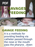 Katori and Spoon Feeding Procedure | PDF | Neonatal Intensive Care Unit ...
