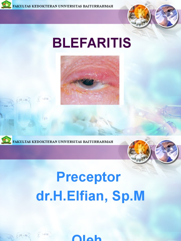 Blefaritis | PDF | Sains & Matematika