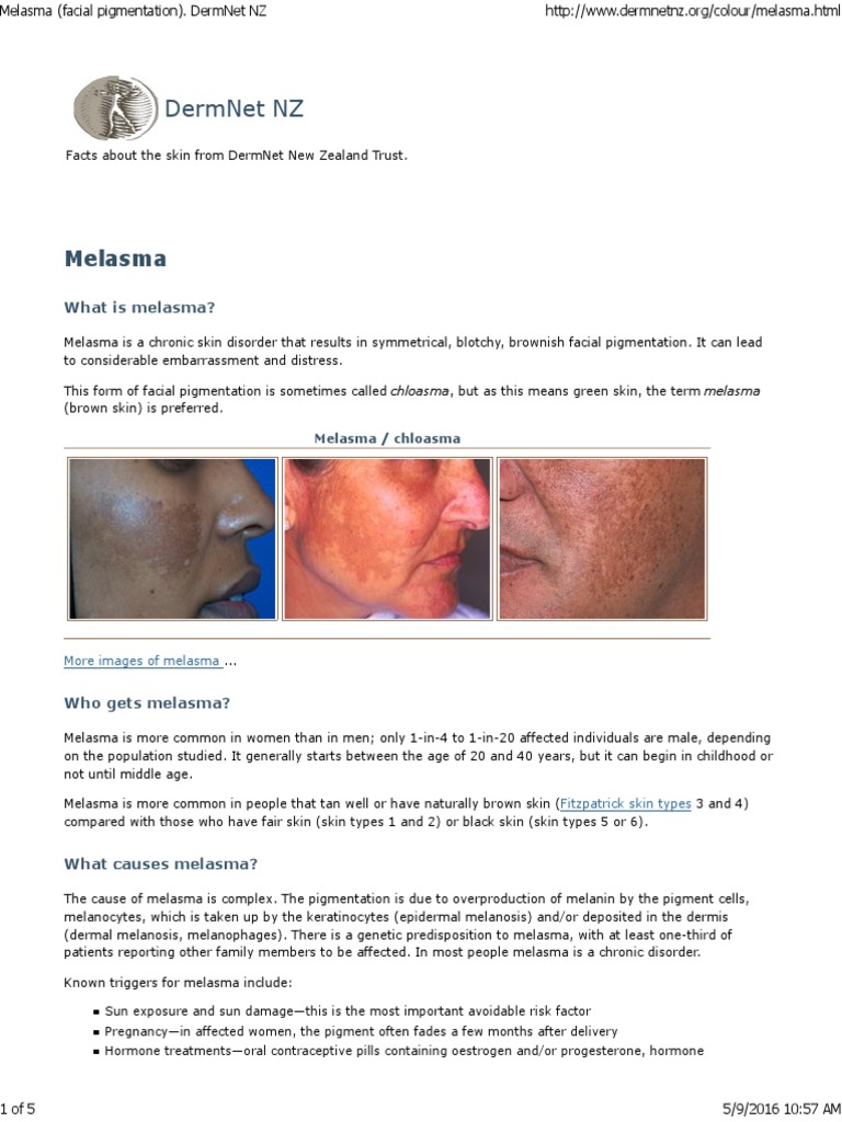 Dermnet NZ: Melasma | Download Free PDF | Topical Medication | Skin