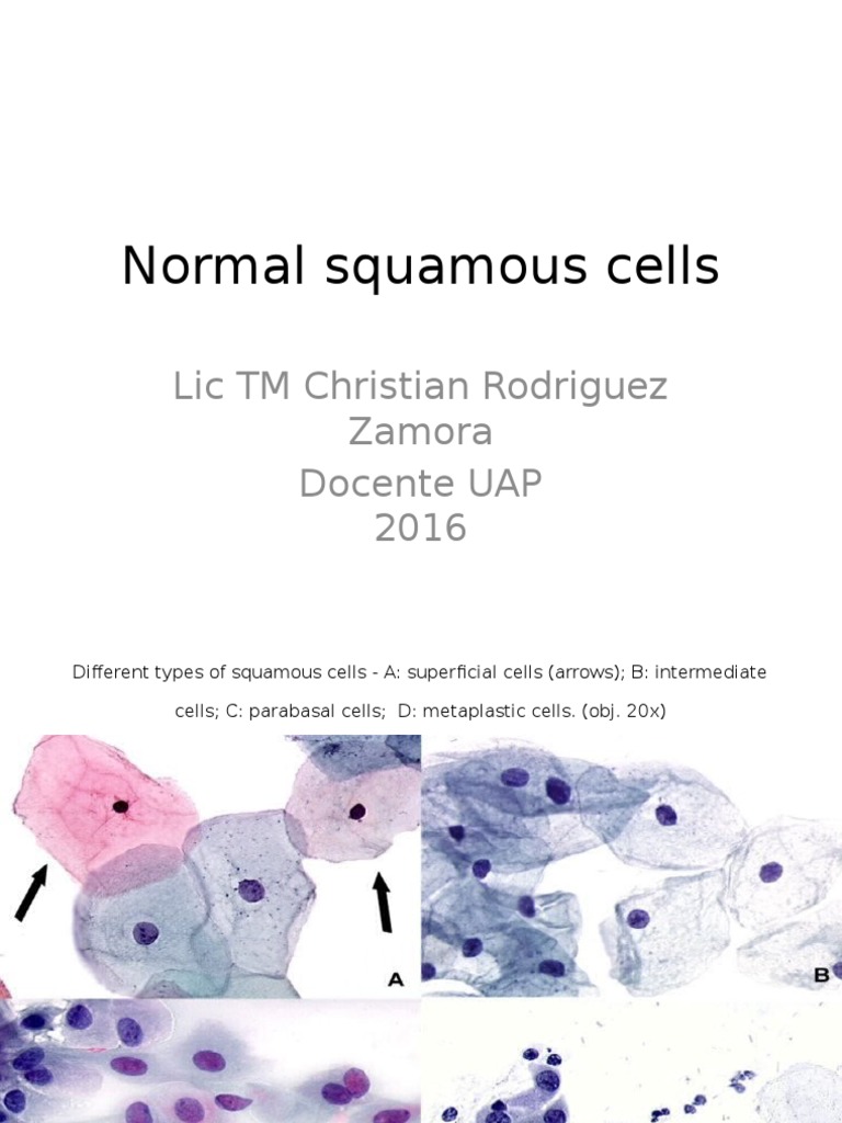 Atlas Normal Squamous Cells | PDF | Epithelium | Histology