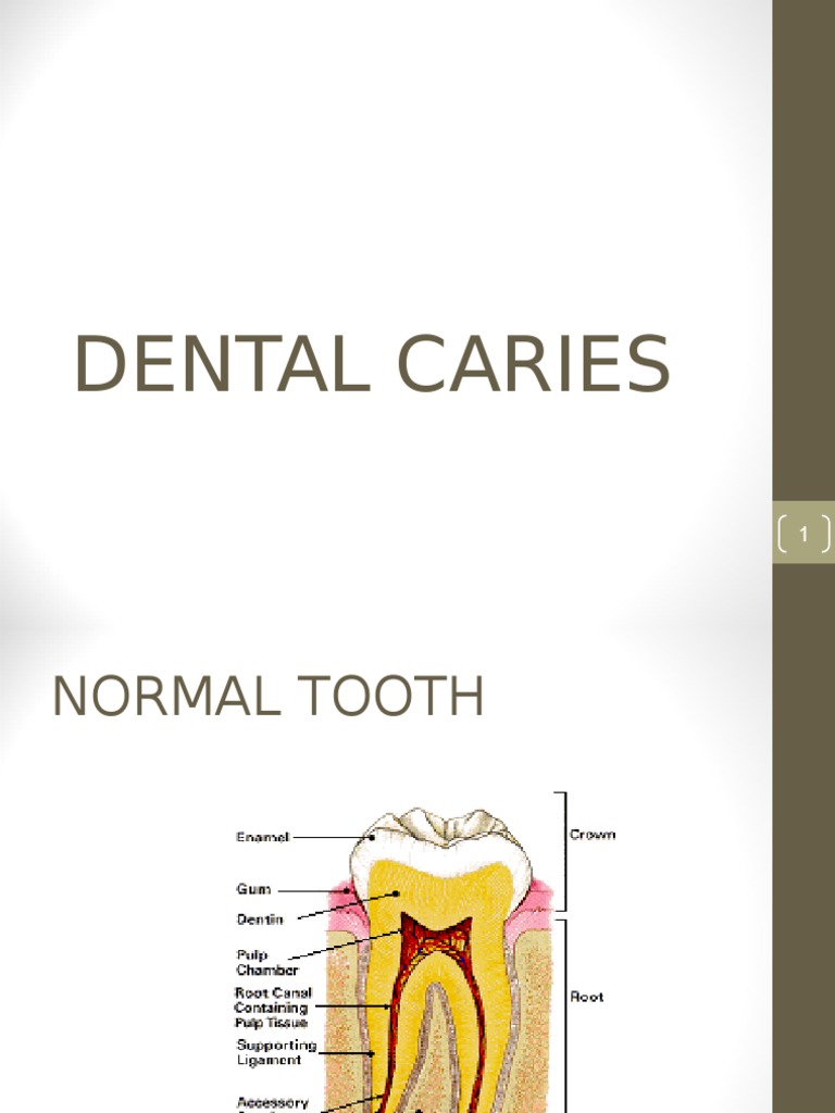Overview of Dental Caries Types and Diagnosis | PDF | Tooth Enamel ...