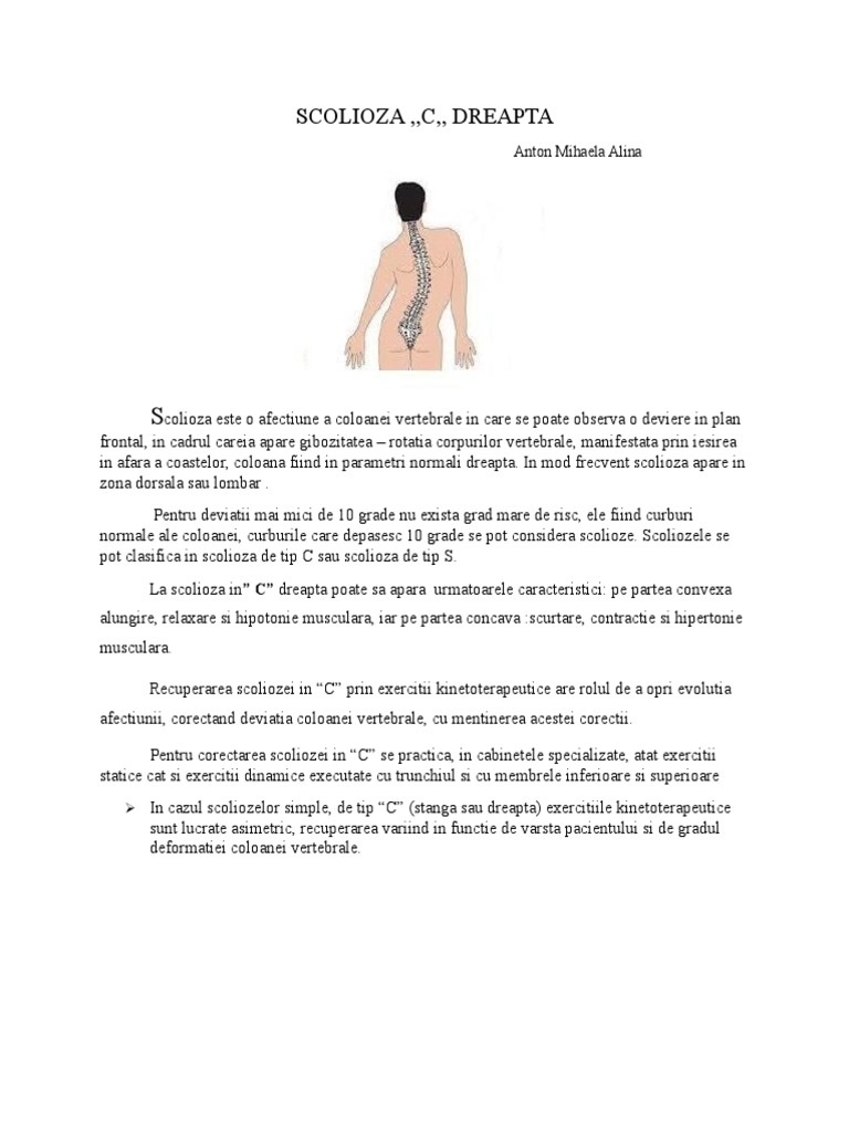 Scolioza in ,,C,, Dreapta