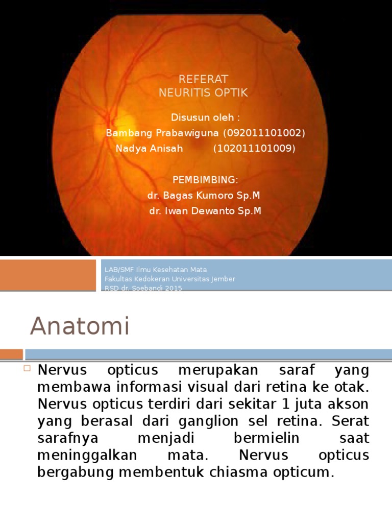 Neuritis Optik | PDF