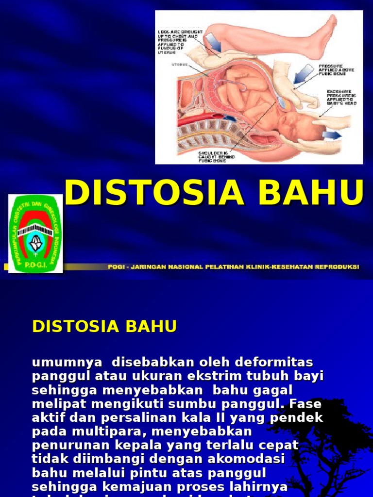 07 Distosia Bahu & Ekst Vakum | PDF