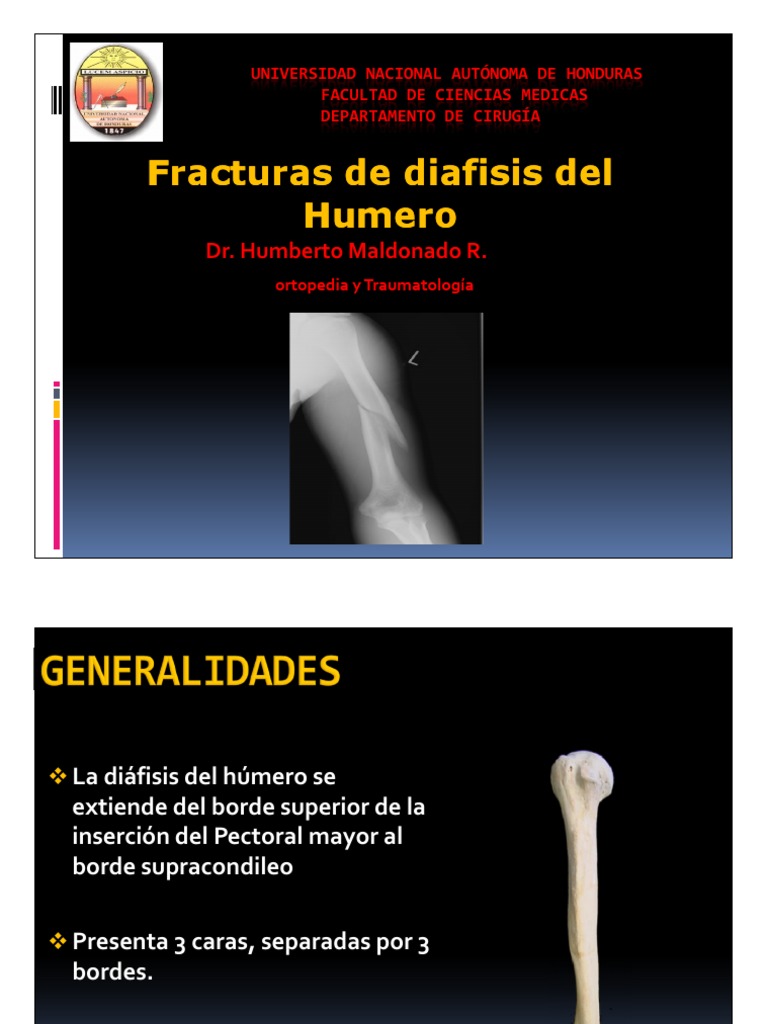 Fracturas de Diafisis de Humero | PDF | Mano | Sistema musculoesquelético