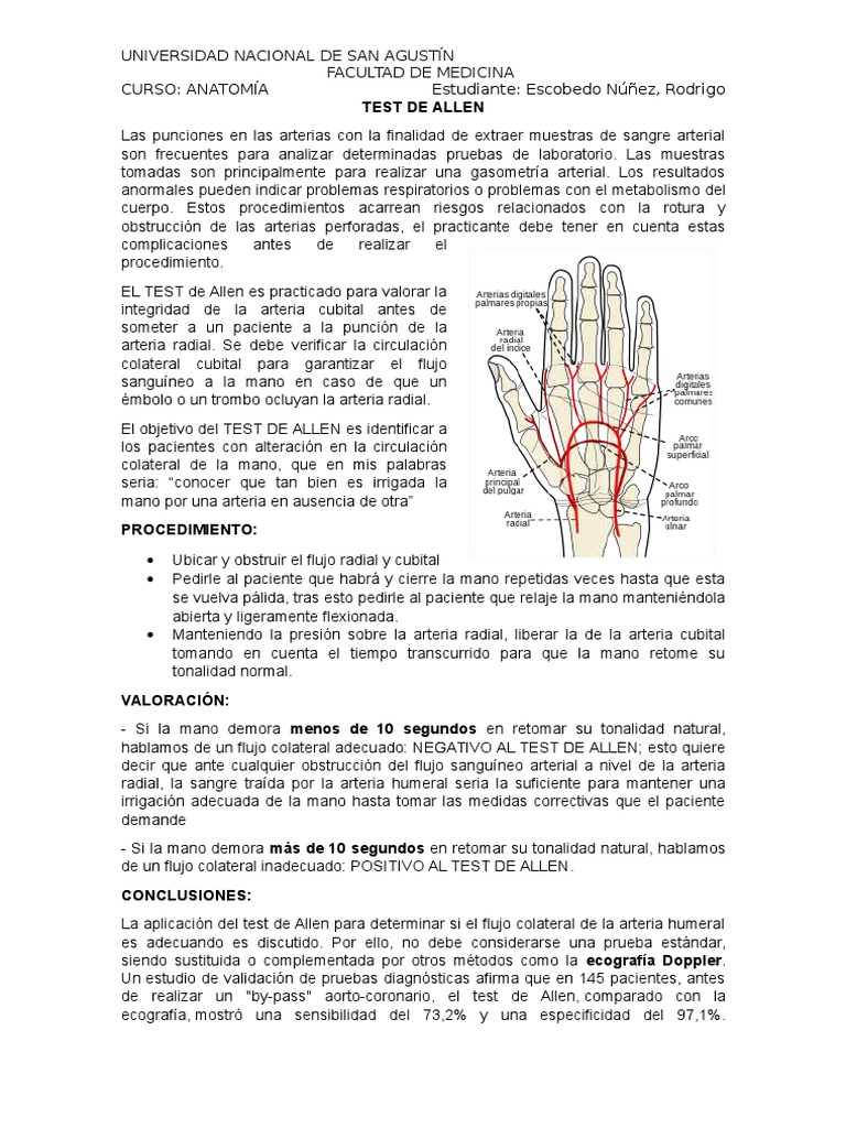 Test de Allen | Artería | Especialidades Medicas