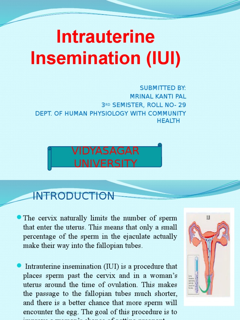Intrauterine Insemination (IUI) : Vidyasagar University | PDF ...