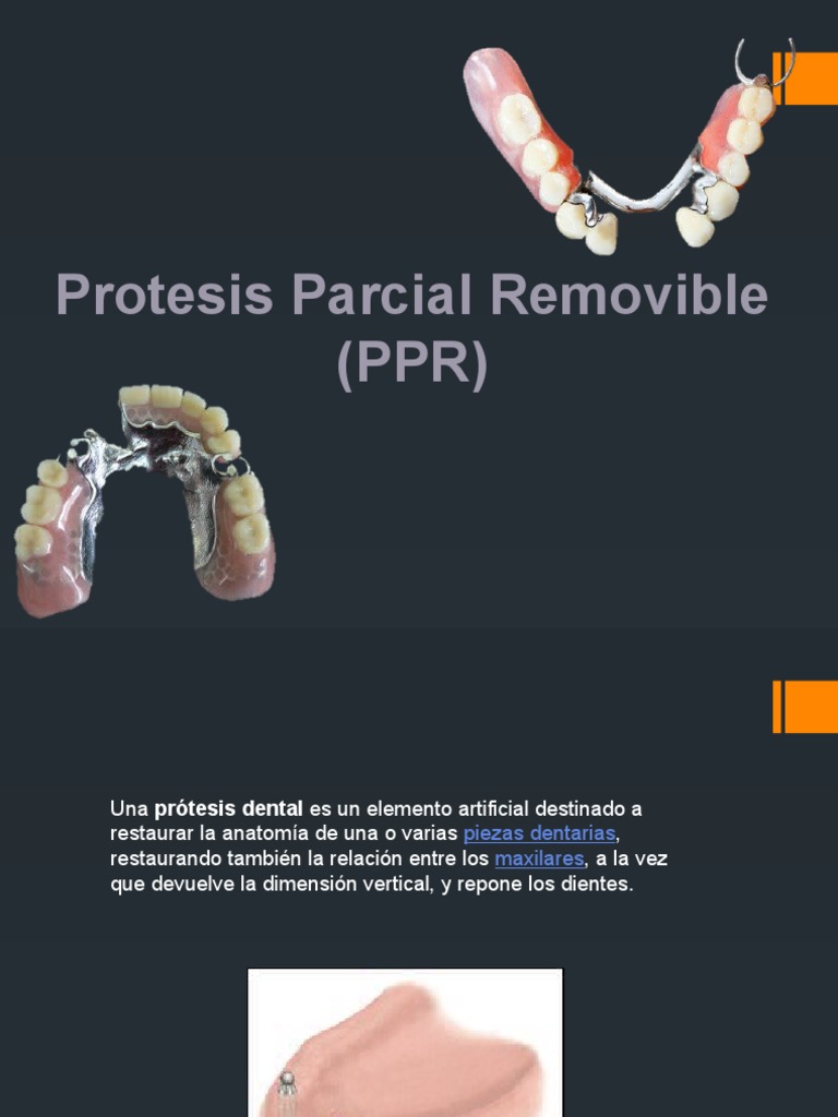 Presentacion Ppr | Dentadura postiza | Diente humano