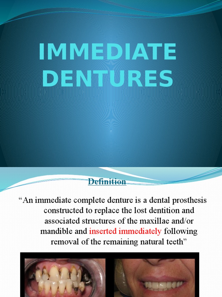 Immediate Dentures | PDF | Dentures | Dentistry Branches