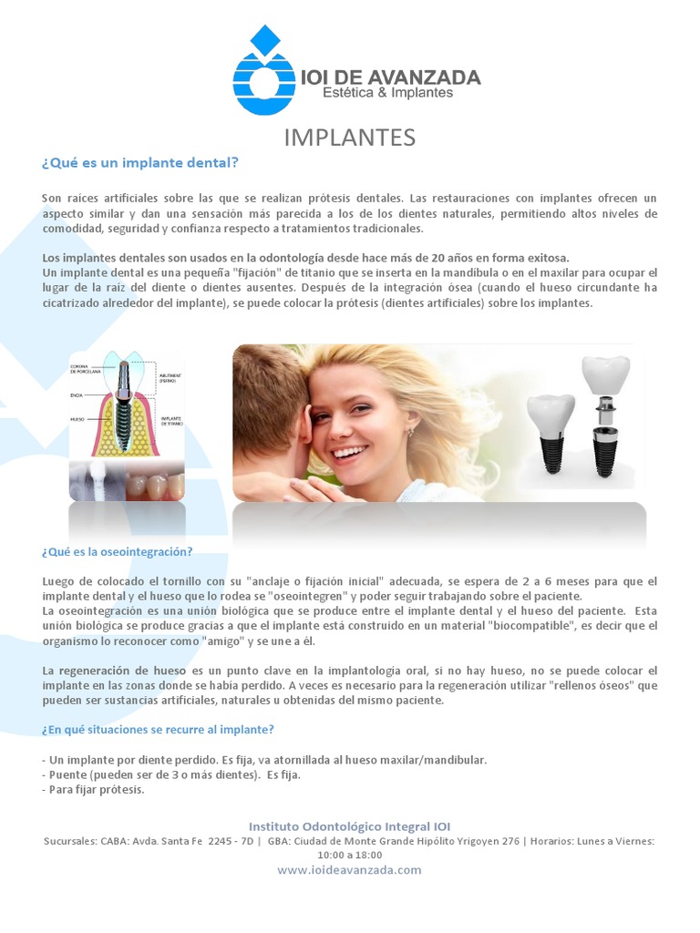 Implantes Dentales IOI de Avanzada | PDF | Implante dental | Medicina