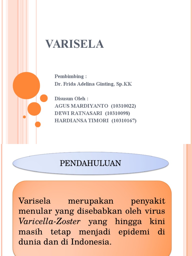Varicella | PDF