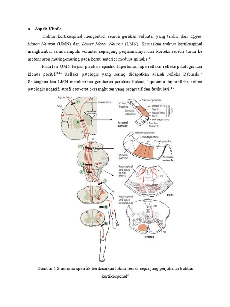Aspek Klinik Lesi Traktus Piramidalis | PDF