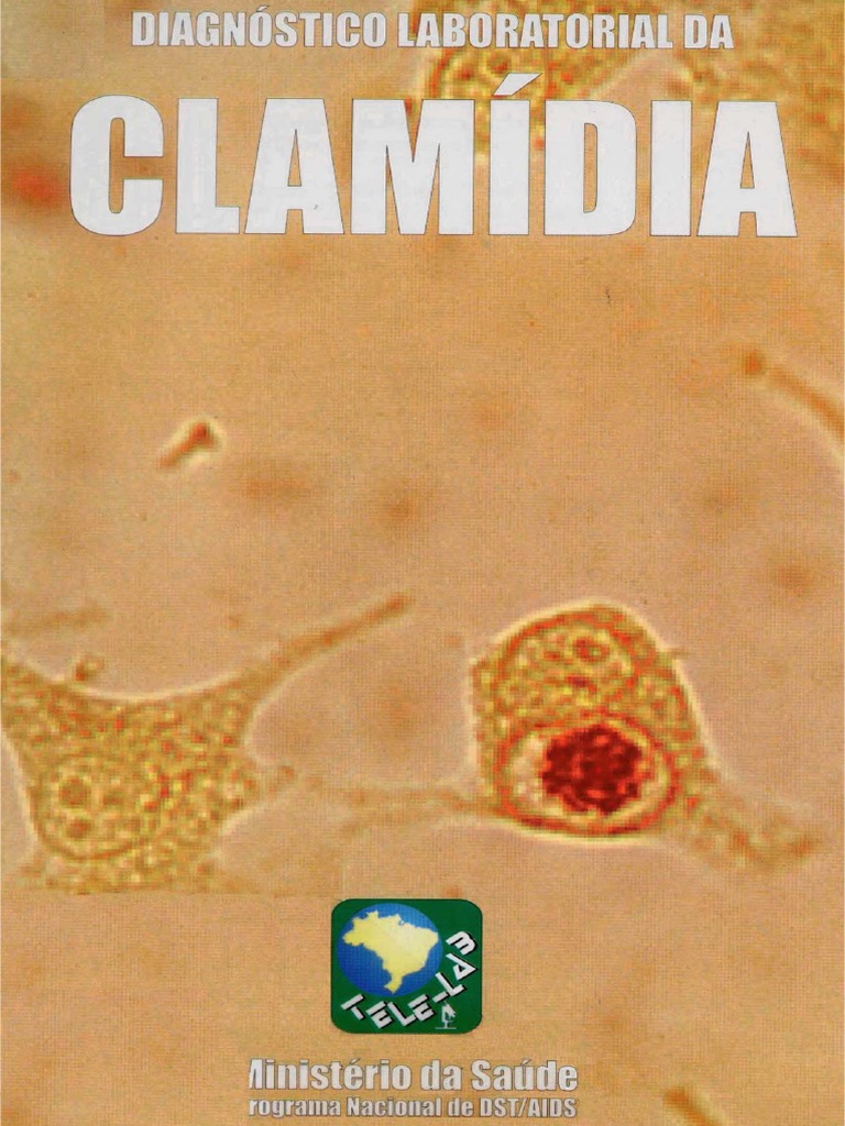 Diagnóstico Laboratorial Da Clamídia | PDF | Elisa | HIV/AIDS