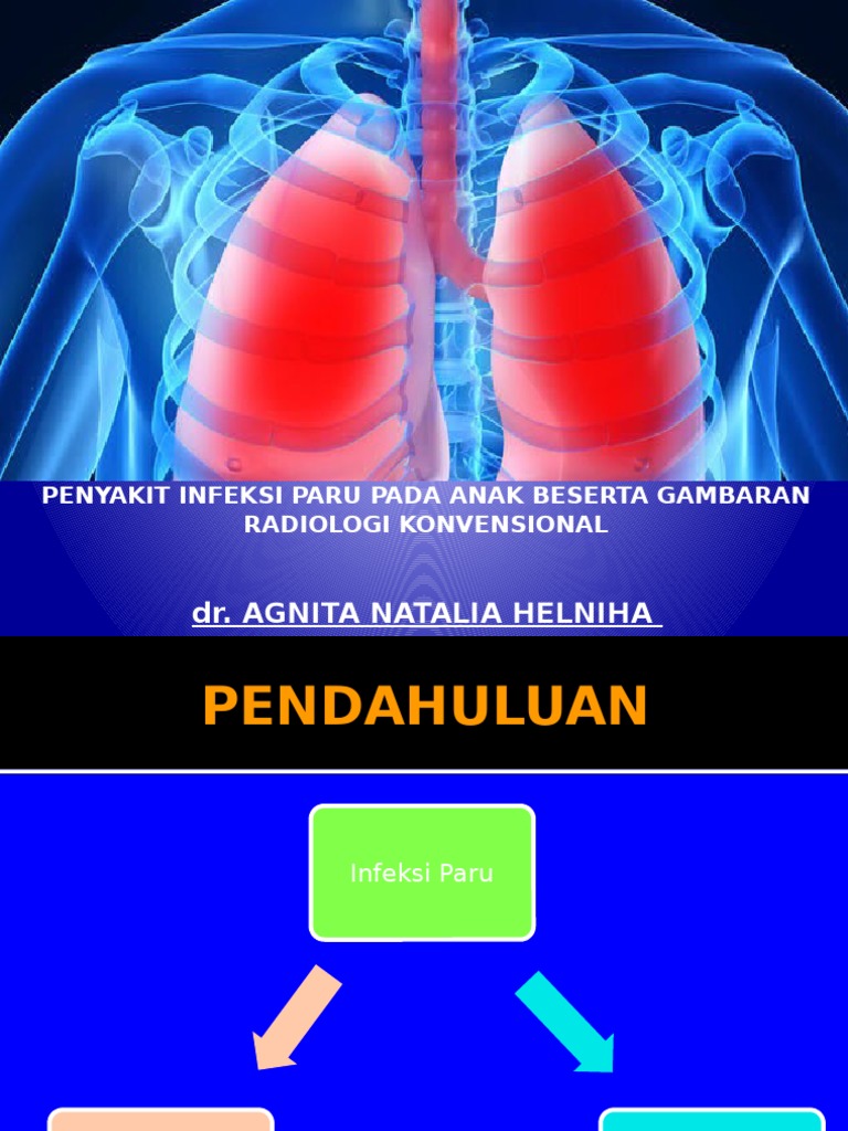 Infeksi Paru Pada Anak - PPTX (Agnita Natalia H) | PDF