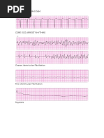 ACLS Post Test Answer Key 2024 | PDF | Cardiopulmonary Resuscitation ...