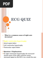 ECG MCQs with Answers for Exam Prep | PDF | Electrocardiography ...