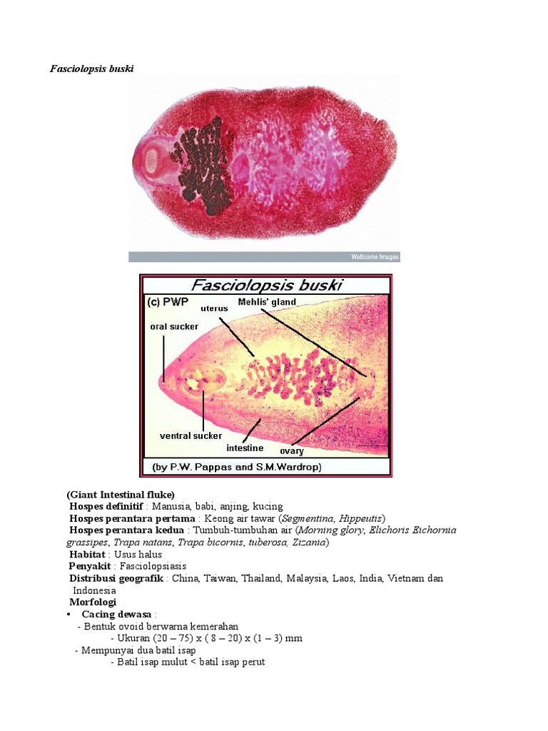 Fasciolopsis Buski: Penyebab Fasciolopsiasis | PDF | Griya & Taman ...
