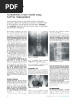 AXR Interpretation - LITFL - CCC Investigations | PDF | Medical ...