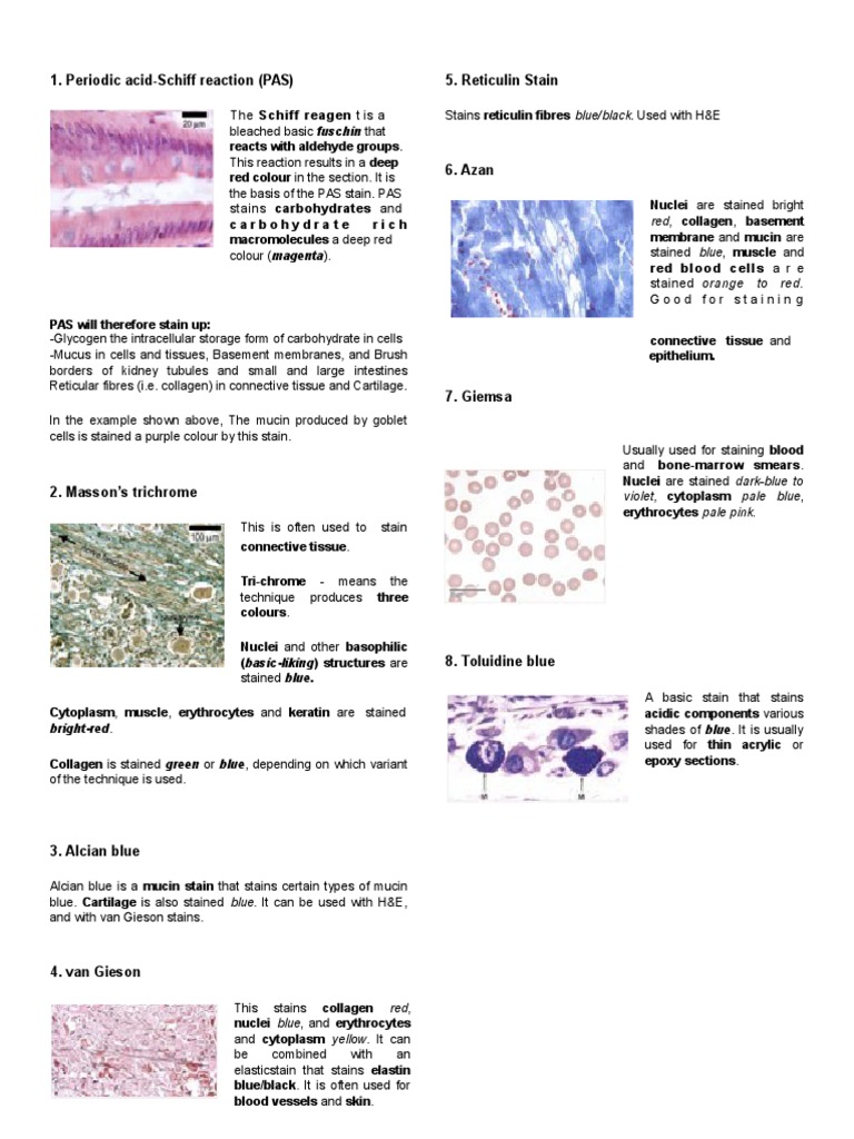 Periodic Acid-Schiff Reaction (PAS) 5. Reticulin Stain: Red, Collagen ...