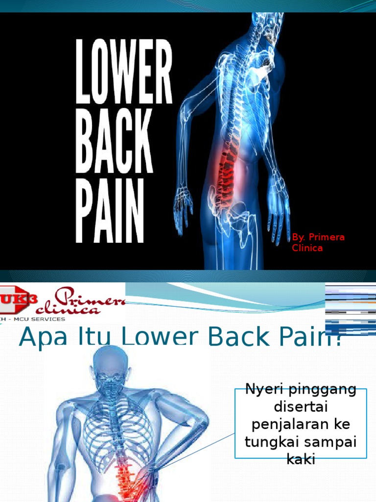 Low Back Pain | PDF