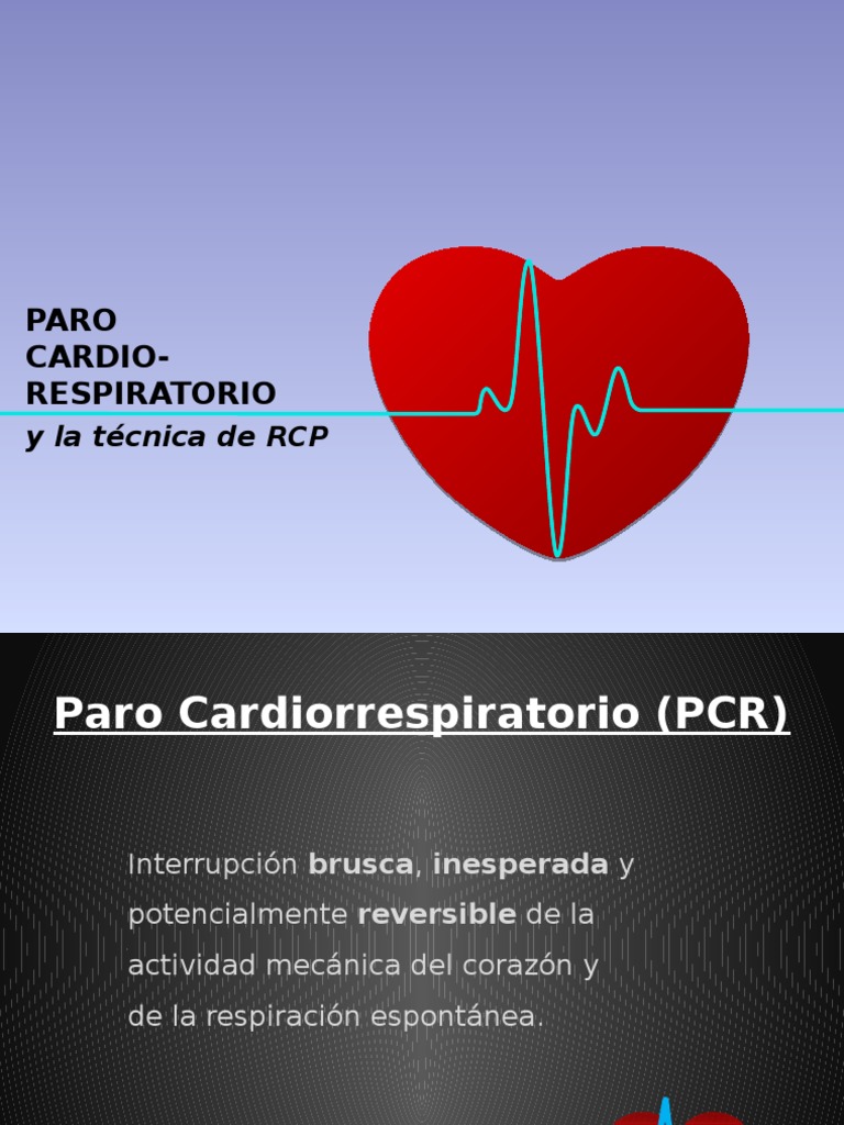 PCR | Reanimación cardiopulmonar | Paro cardíaco