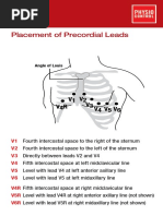 12 Lead ECG Placement Guide | PDF | Cardiology