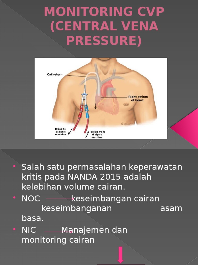 Pemantauan dan Pemasangan CVP dalam Keperawatan | PDF | Sains & Matematika