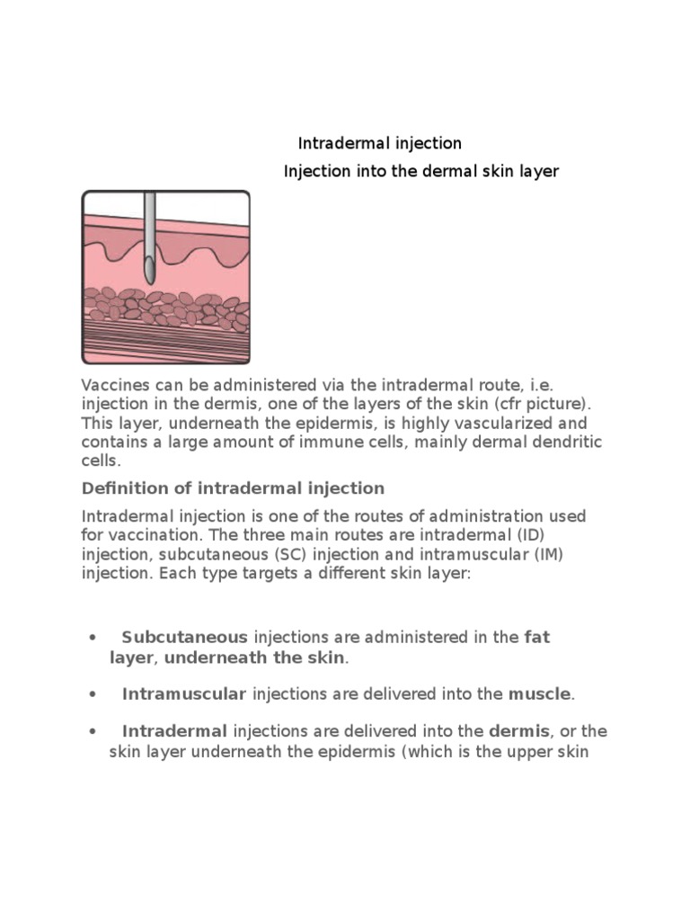 Intradermal Injection: Vaccine Route Targeting Skin's Dermal Layer | PDF