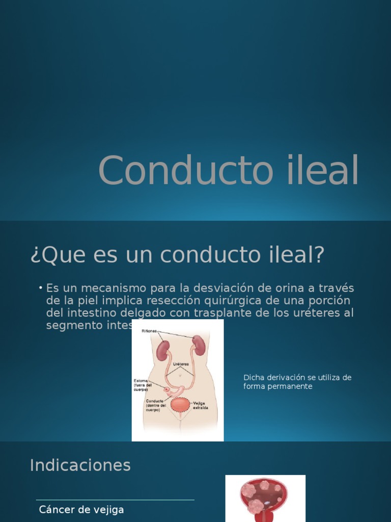Conducto Ileal: Procedimiento y Cuidados | PDF | Residuos | Ciencias de ...