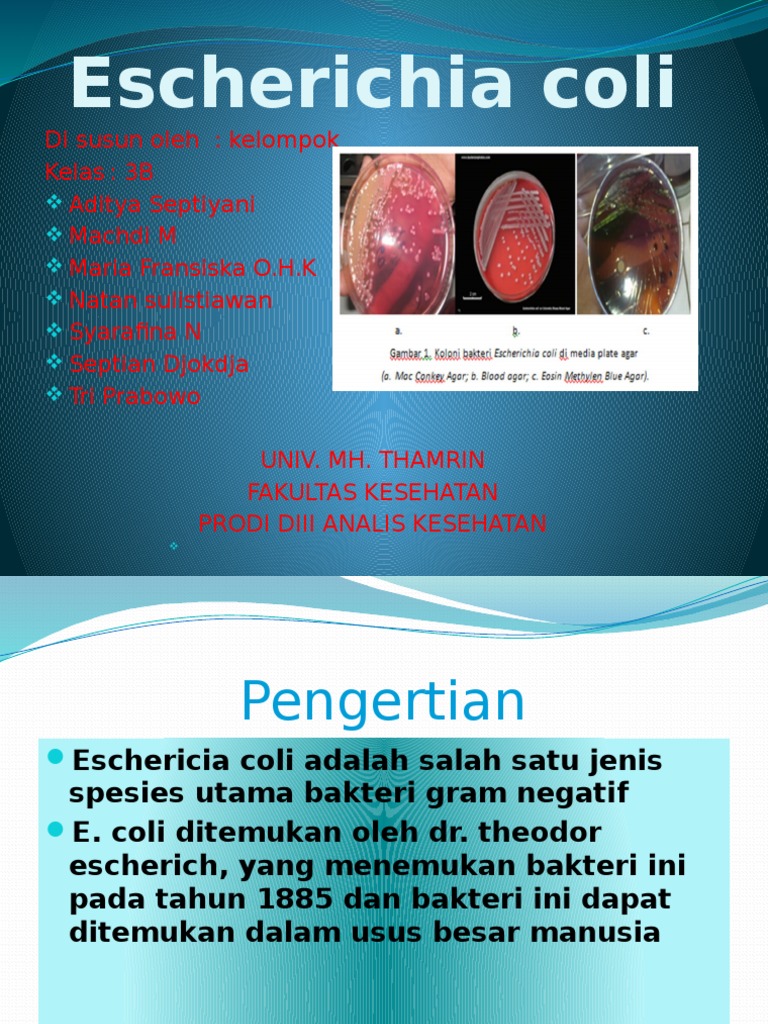 E.coli PPT Maria | PDF